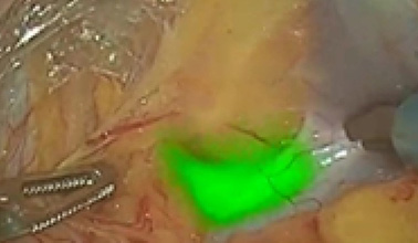 VIRON X System: Our new imaging portfolio